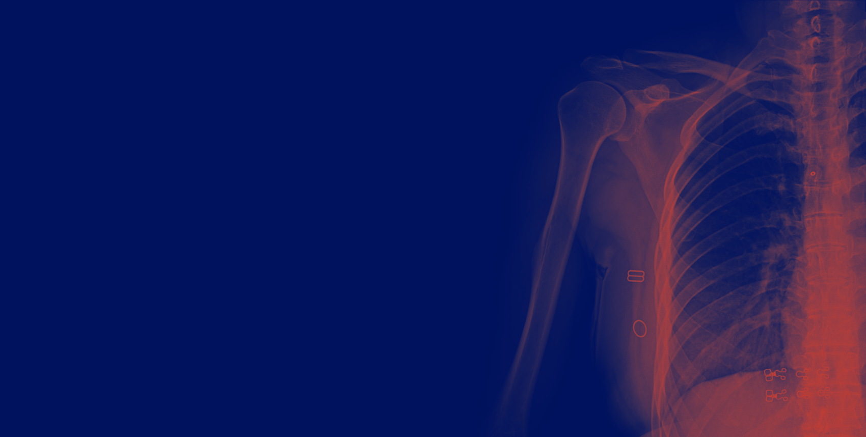 Working at Radius | Radius Health