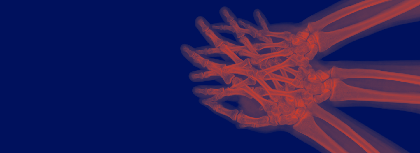 Partnering | Radius Health