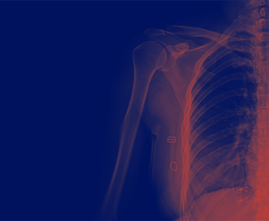 Working at Radius | Radius Health